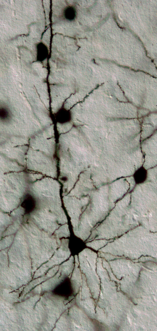 A pyramidal neuron in the mouse cerebral cortex is labeled using the ...